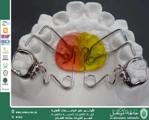 The Pendulum Appliance in Orthodontics: Uses and Benefits